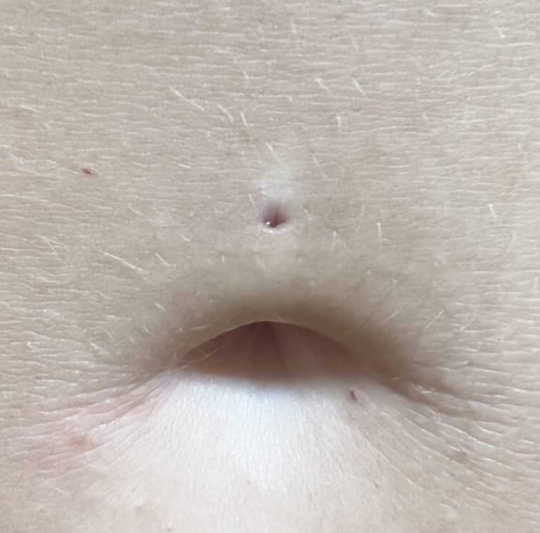 How Bad Does a Belly Button Piercing Hurt: Unveiling the Truth