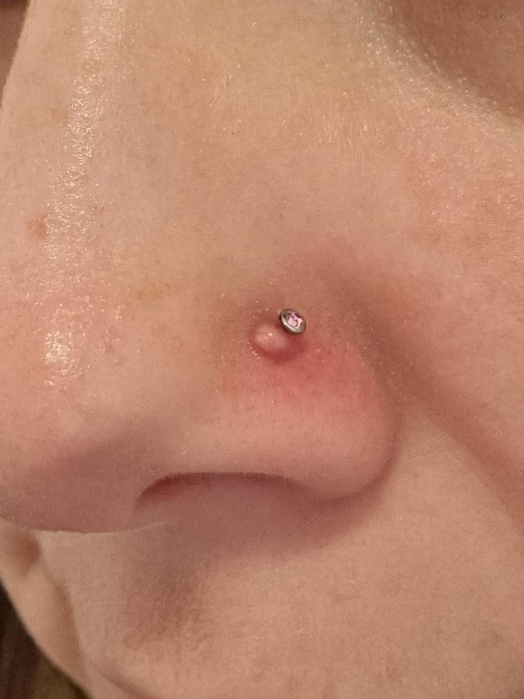 How to Get Rid of Nose Piercing Bump: Proven Solutions